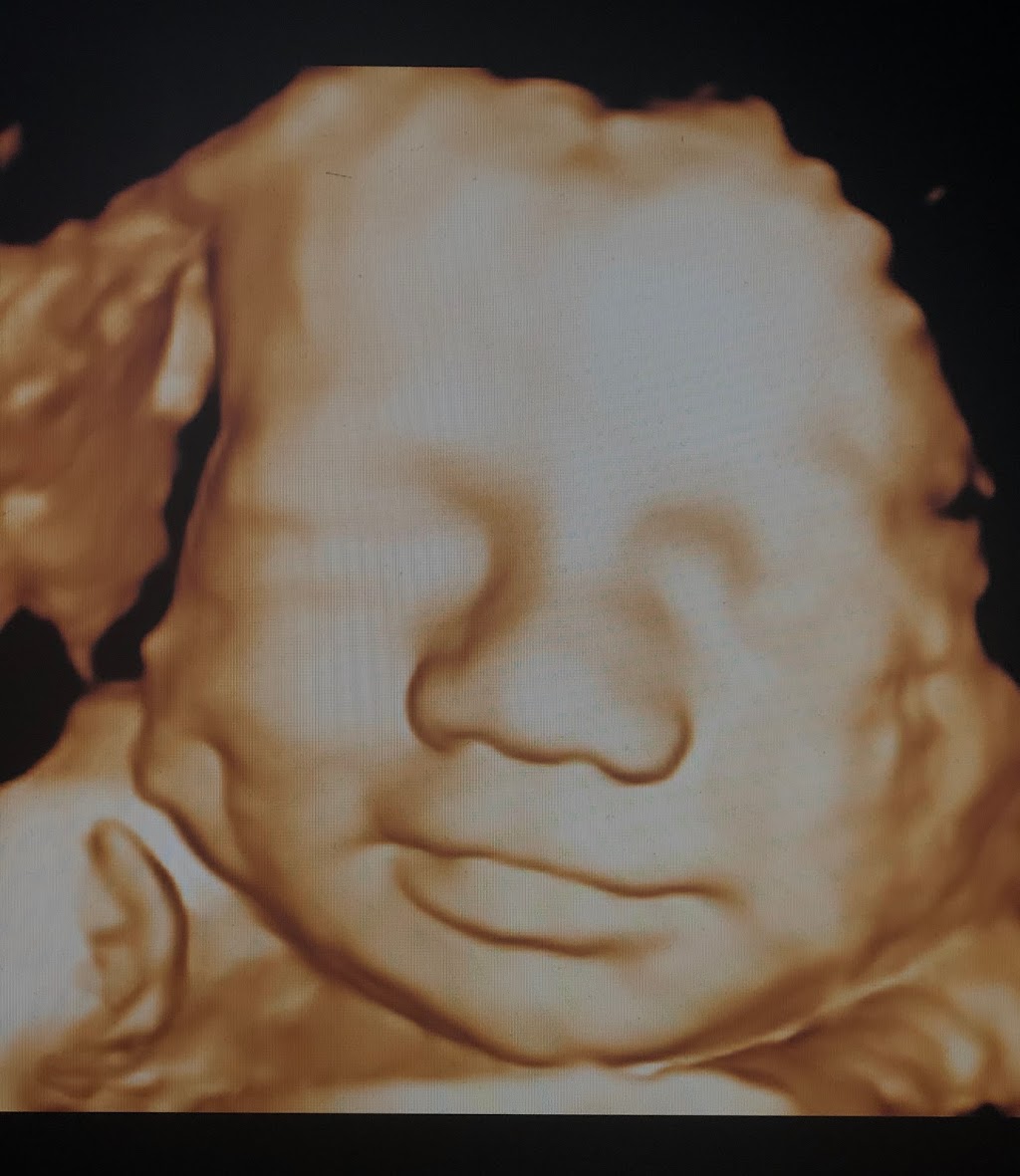 Newcrest Baby Imaging 3D Baby Ultrasound Scans Newcastle NSW 26 Newcrest Baby Imaging 3D Baby Ultrasound Scans Newcastle NSW 26